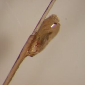 Eggs of Lice, Louse Egg - How many eggs can a Louse lay?